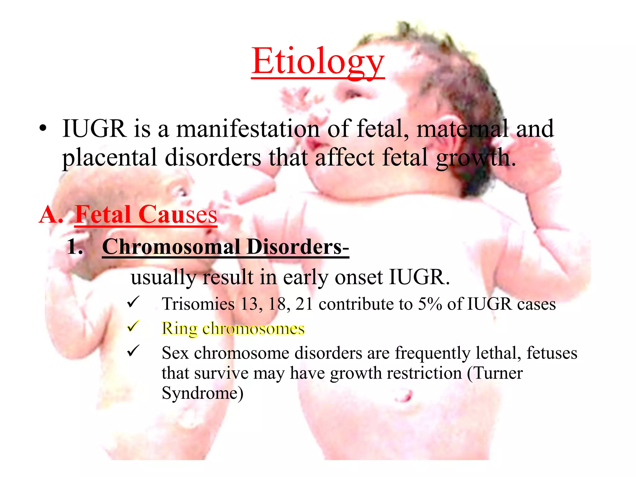 Aetiology and classification of IUGR by- ANANY GUPTA (KGMU) | PPTX