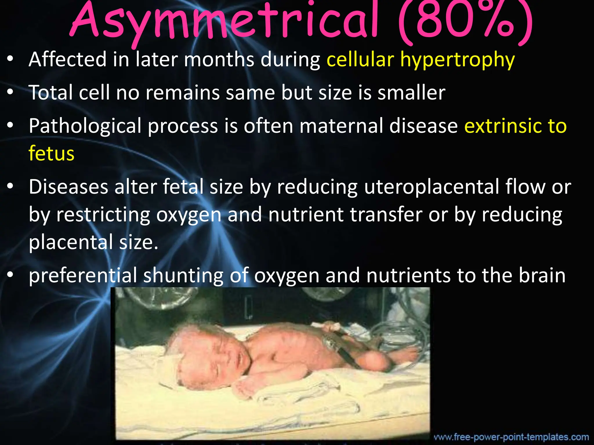 iugr-180818145504 (1).pdf