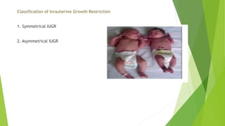 IUGR.pptx
