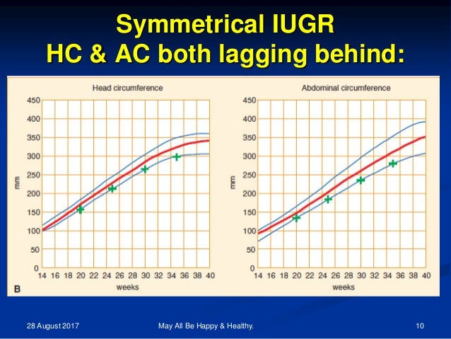 IUGR for 4th year med.students