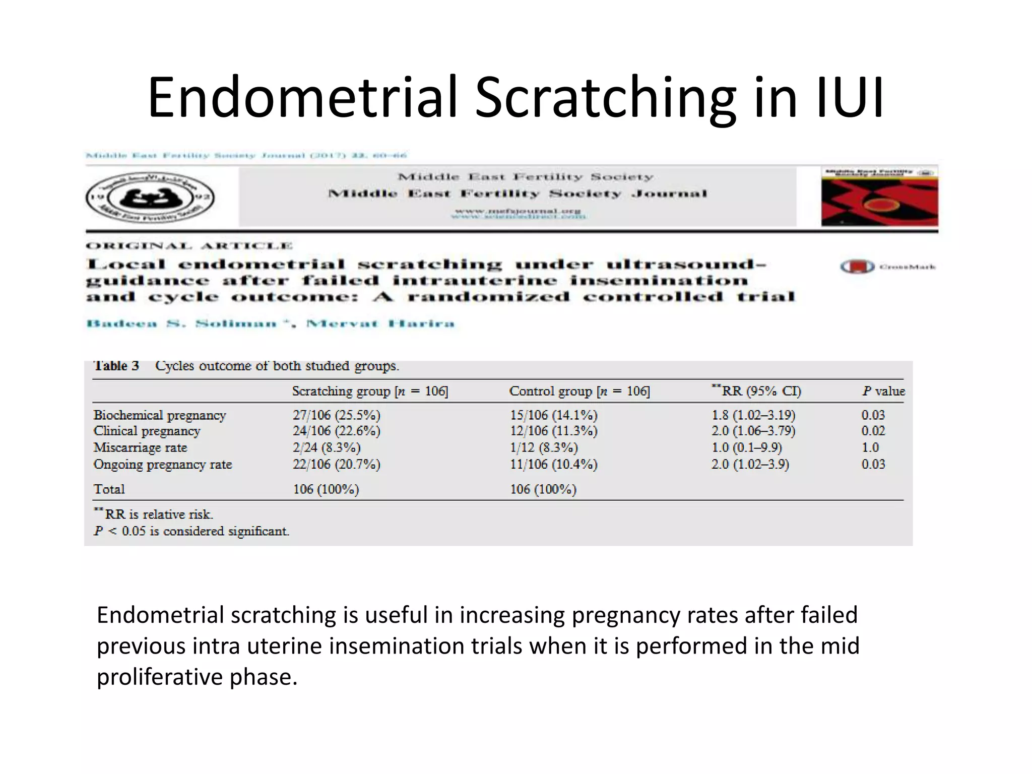 Role of IUI in the era of IVF | PPTX