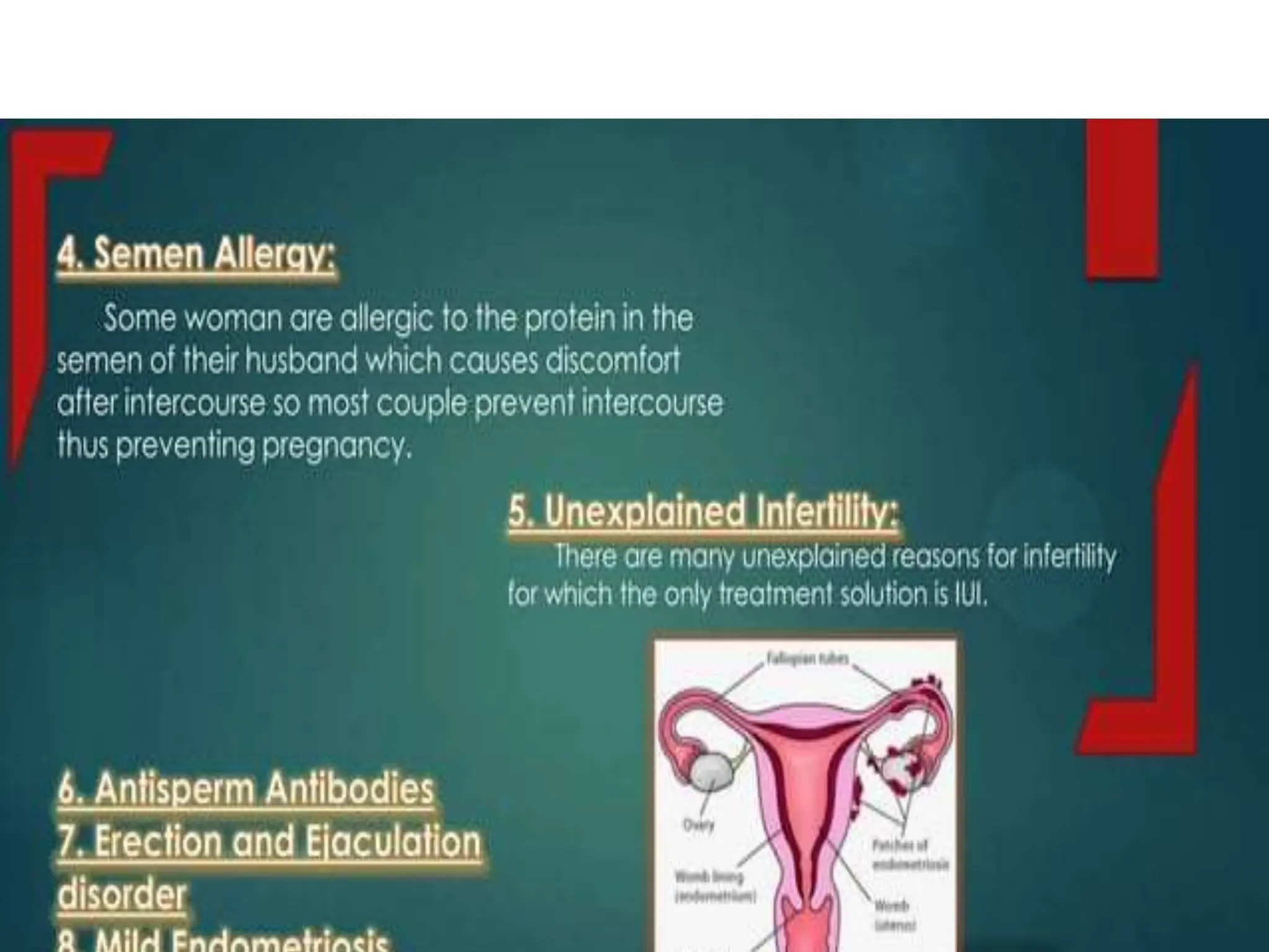 Intra uterine insemination (IUI) Indication | PPTX