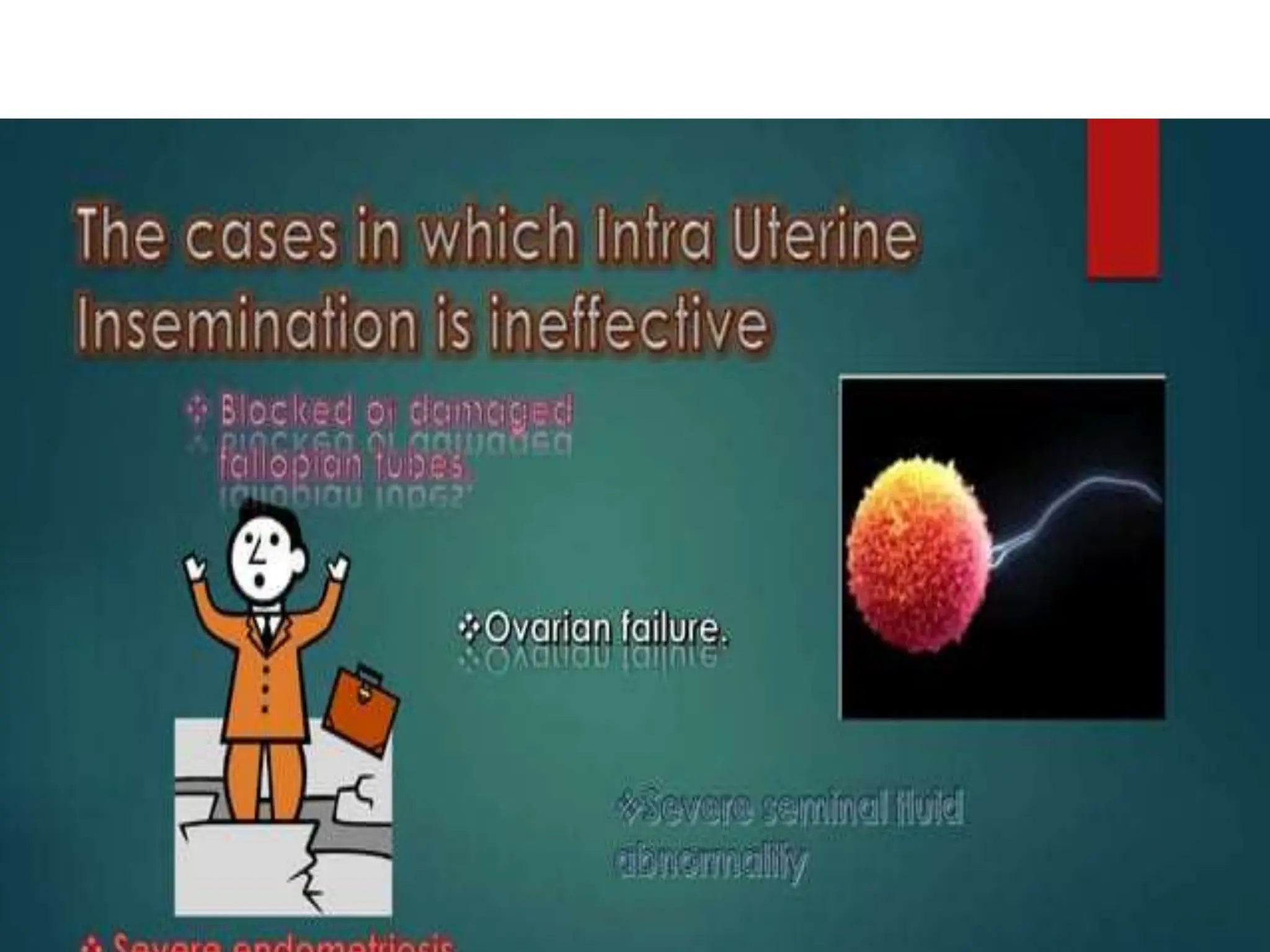 Intra uterine insemination (IUI) Indication | PPTX