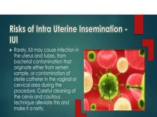 Intra uterine insemination (IUI) Indication | PPT
