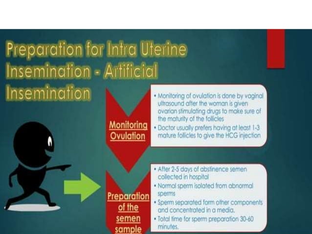 Intra uterine insemination (IUI) Indication | PPT