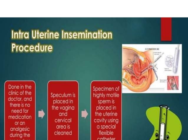 Intra uterine insemination (IUI) Indication | PPTX