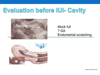 IUI-Patient Selection and Indications for IUI | PPTX