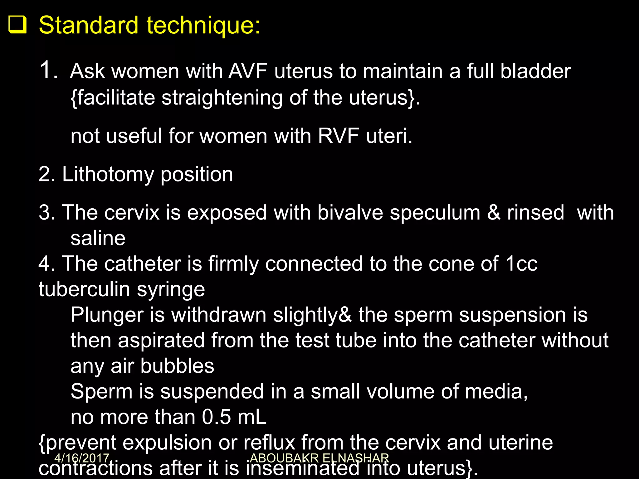 Intrauterine Insemination | PPSX