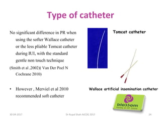 Intrauterine Insemination-Clinician's Perspectives | PPTX