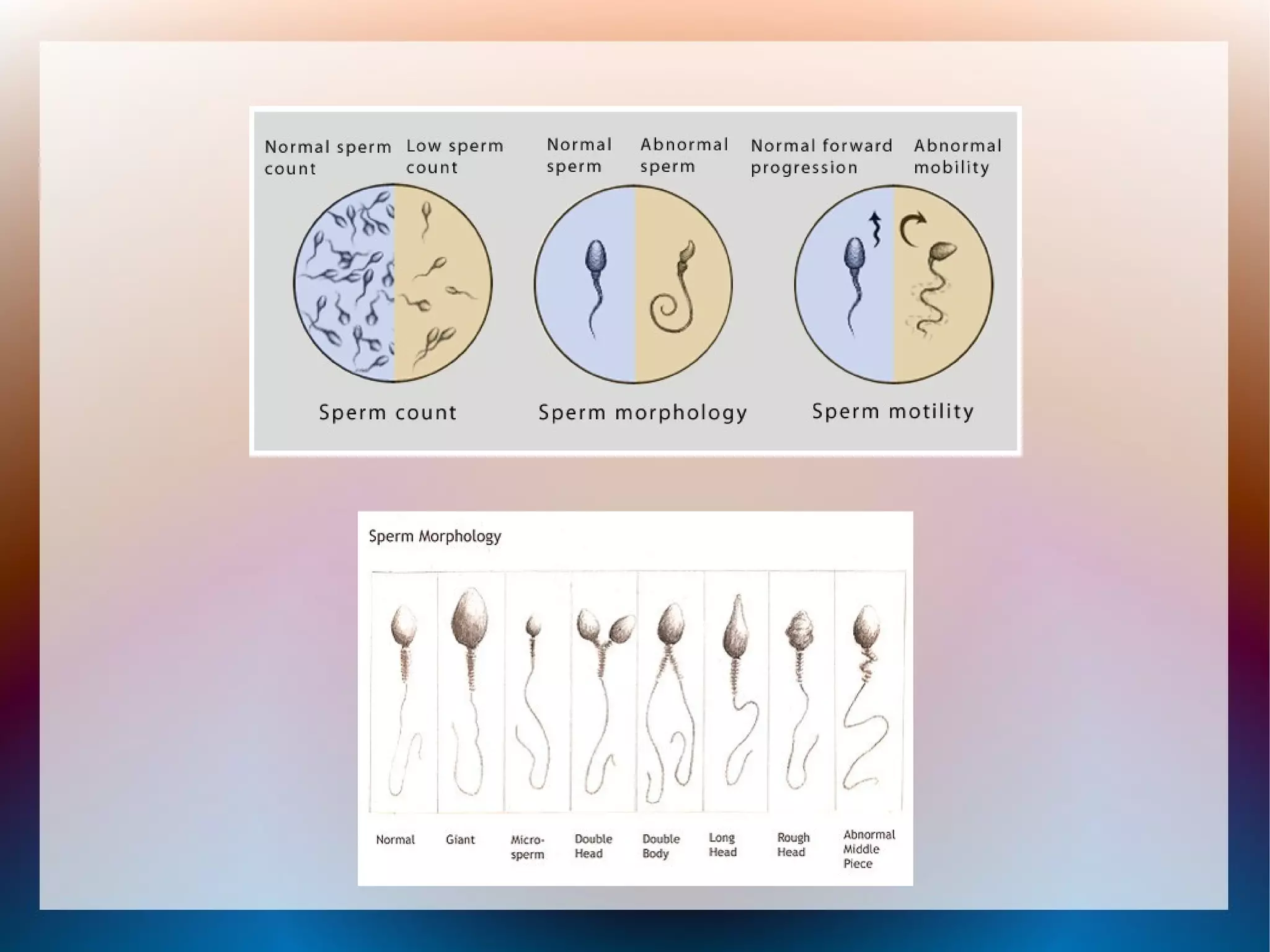 Intra Uterine Insemination | ODP