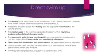 Intrauterine Insemintion IUI powerpoint presentation | PPTX