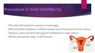 Intrauterine Insemintion IUI powerpoint presentation | PPTX