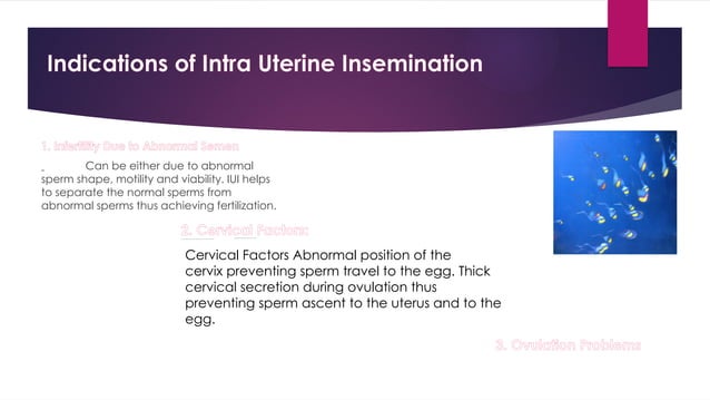 Intrauterine Insemintion IUI powerpoint presentation | PPTX