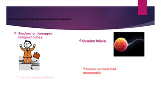 Intrauterine Insemintion IUI powerpoint presentation | PPTX