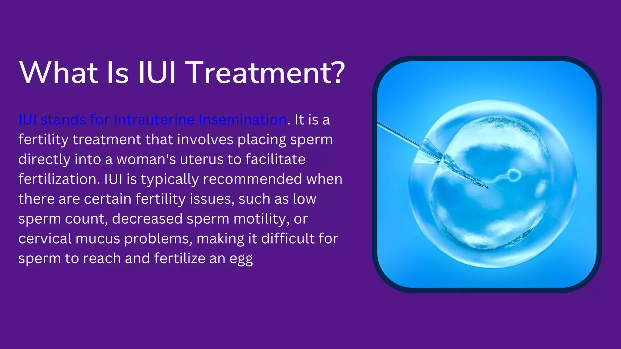 IUI treatment Step By Step Procedure .pptx