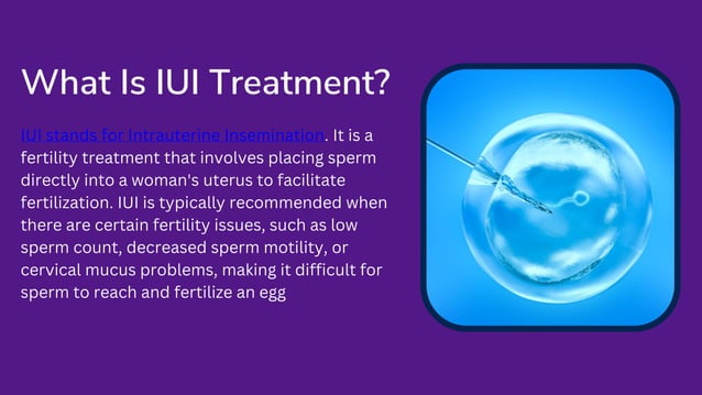 IUI treatment Step By Step Procedure .pptx
