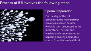 IUI treatment Step By Step Procedure .pptx
