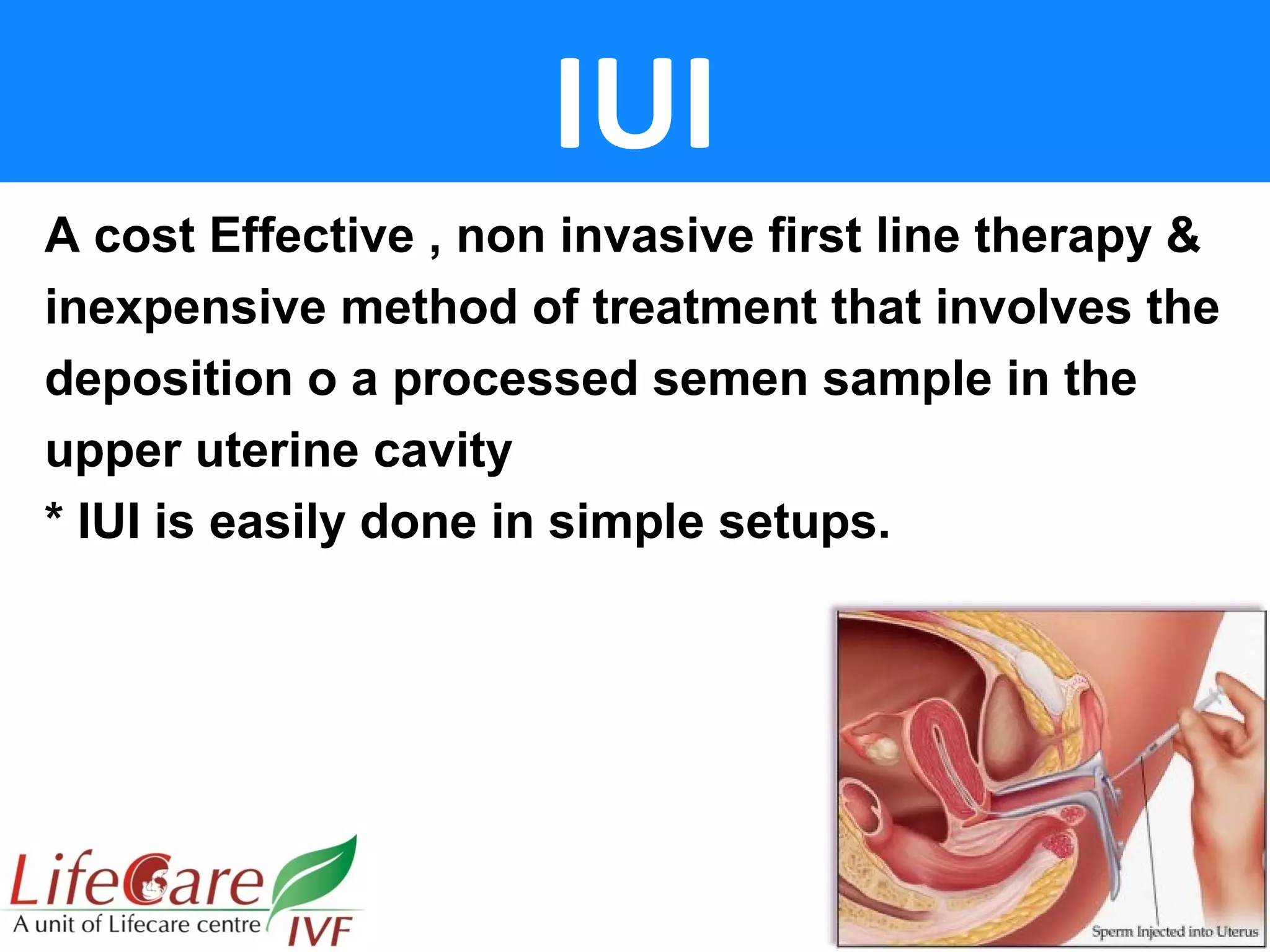 Intrauterine Insemination UPDATE 2018 | PPT