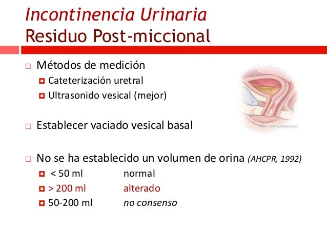 Incontinencia Urinaria y Prolapso de Organo Pelvico: Evaluacion