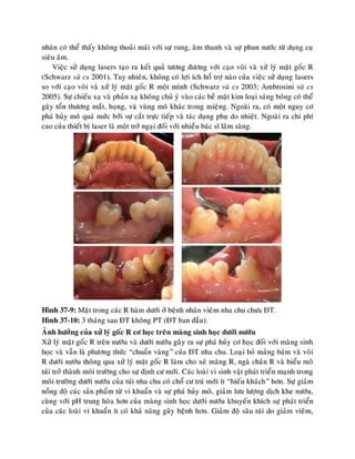 điều trị nha chu không phẫu thuật.pdf