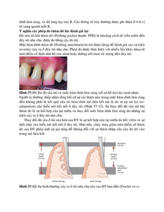 điều trị nha chu không phẫu thuật.pdf