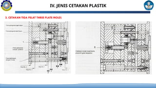 JENIS-JENIS CETAKAN INJEKSI MOLDING PLASTIK | PPTX