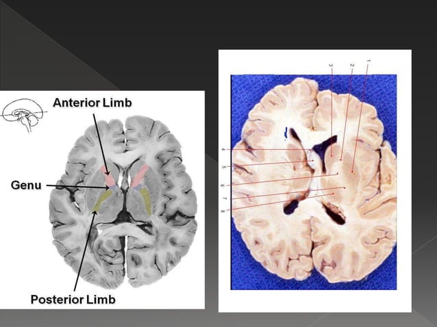 Pyramidal tract and extra pyramidal tracts | PPTX