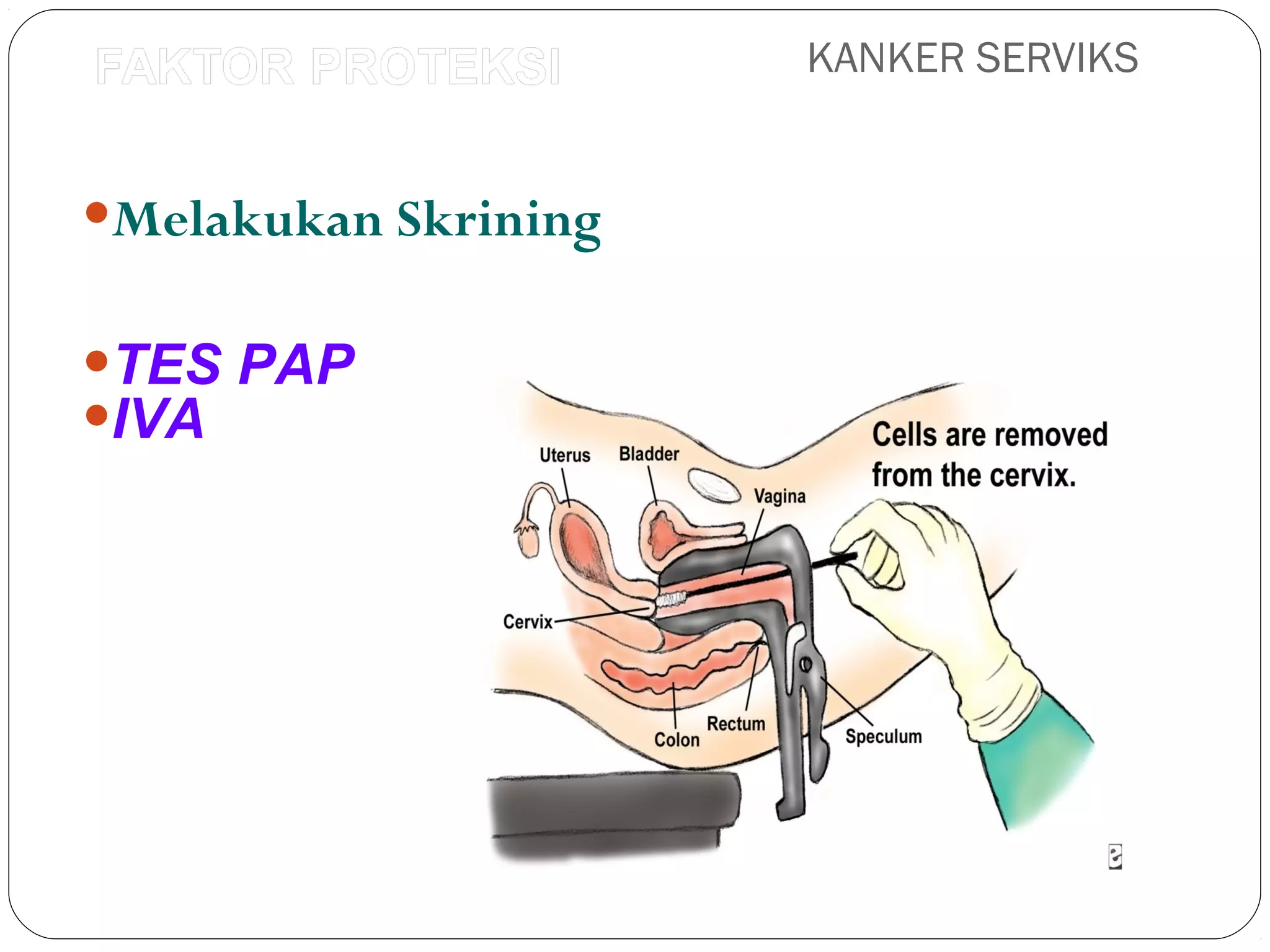 Skrining kanker cerviks dengan IVA | PPT