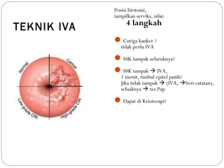 Skrining kanker cerviks dengan IVA | PPT