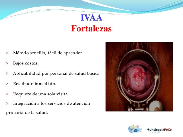 IVAA