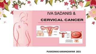 IVA & Ca Cerviks PKM Karanganyar.pptx