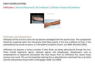 Iv access | PPT
