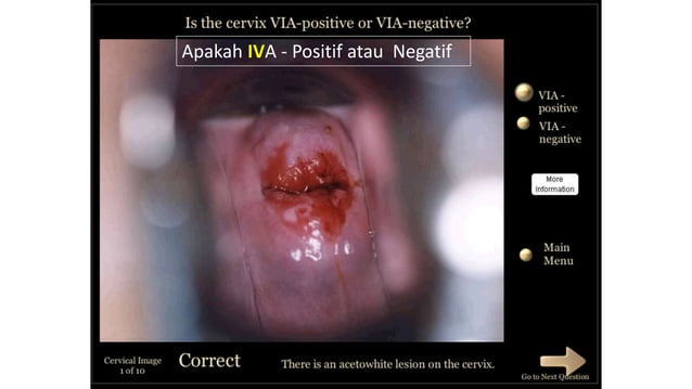 IVA DoIVA TeleDoIVA dr. Sarah Dina.p.ssptx | PPT