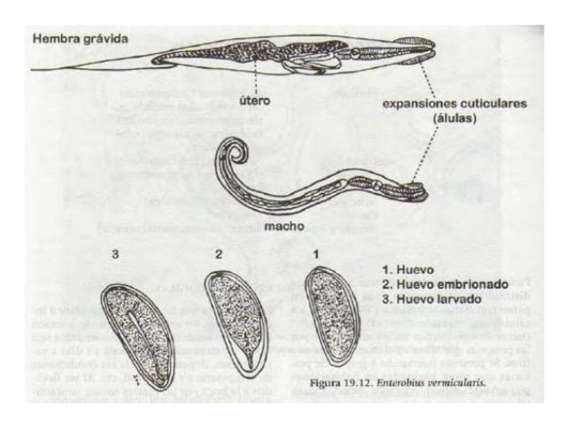 ENTEROBIOSIS U OXIURIASIS
