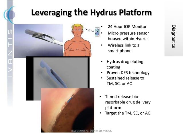 Anterior Segment Company Showcase - Ivantis | PPTX