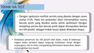 IVA TEST DR. NANANG.pptx
