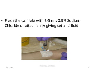 iv cannula.pptx