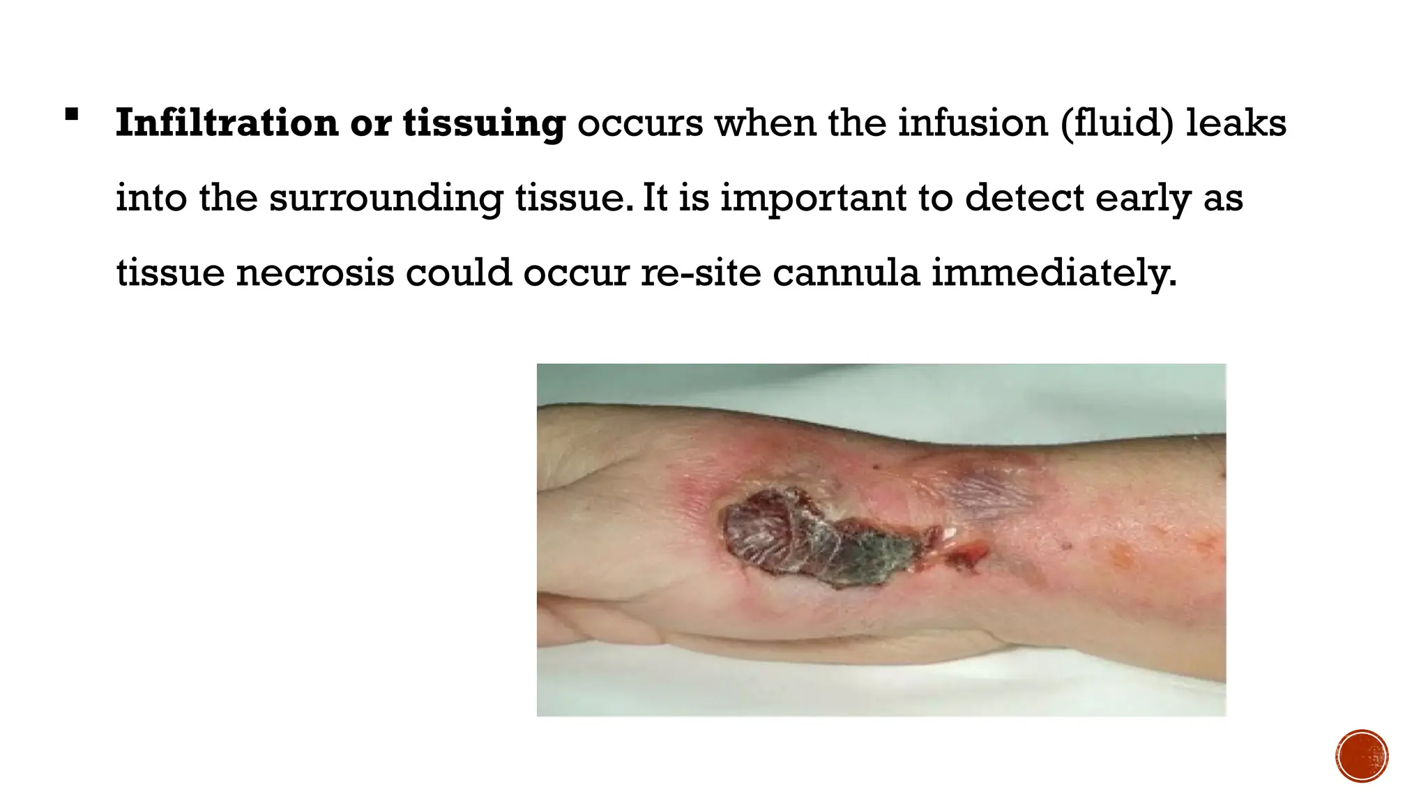 Intravenous (IV) Cannulation - Dr.Rajib Hossain.pptx