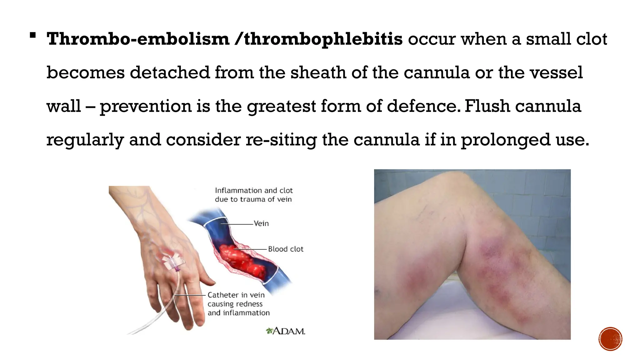 Intravenous (IV) Cannulation - Dr.Rajib Hossain.pptx