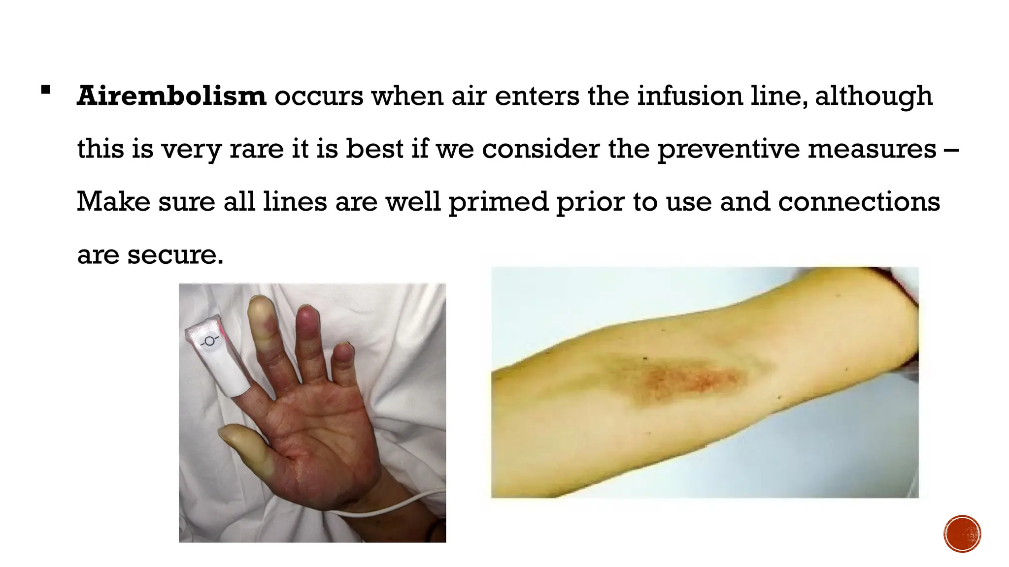 Intravenous (IV) Cannulation - Dr.Rajib Hossain.pptx