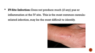 Intravenous (IV) Cannulation - Dr.Rajib Hossain.pptx