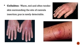 Intravenous (IV) Cannulation - Dr.Rajib Hossain.pptx