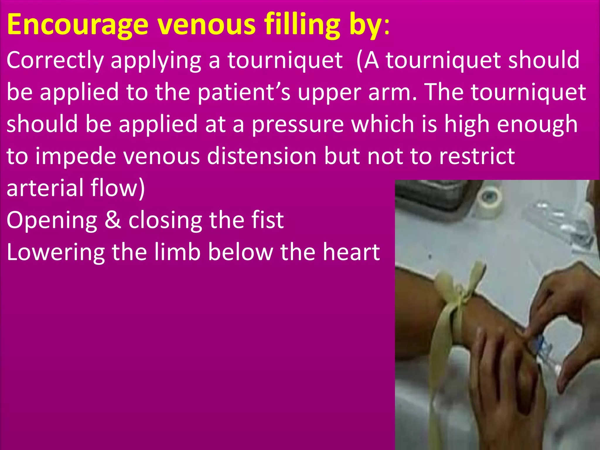 IV CANNULA INSERTION | PPTX