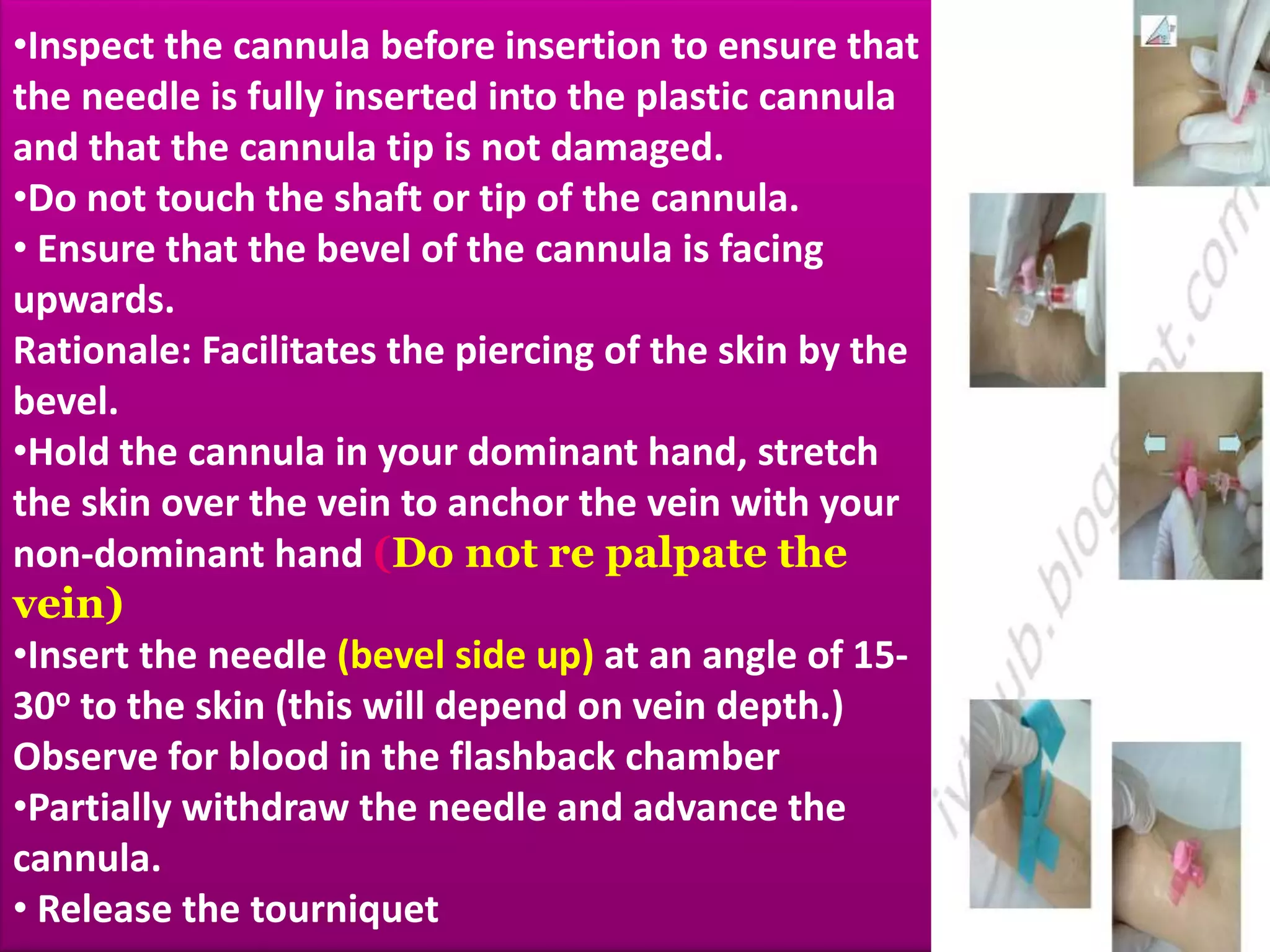IV CANNULA INSERTION | PPTX