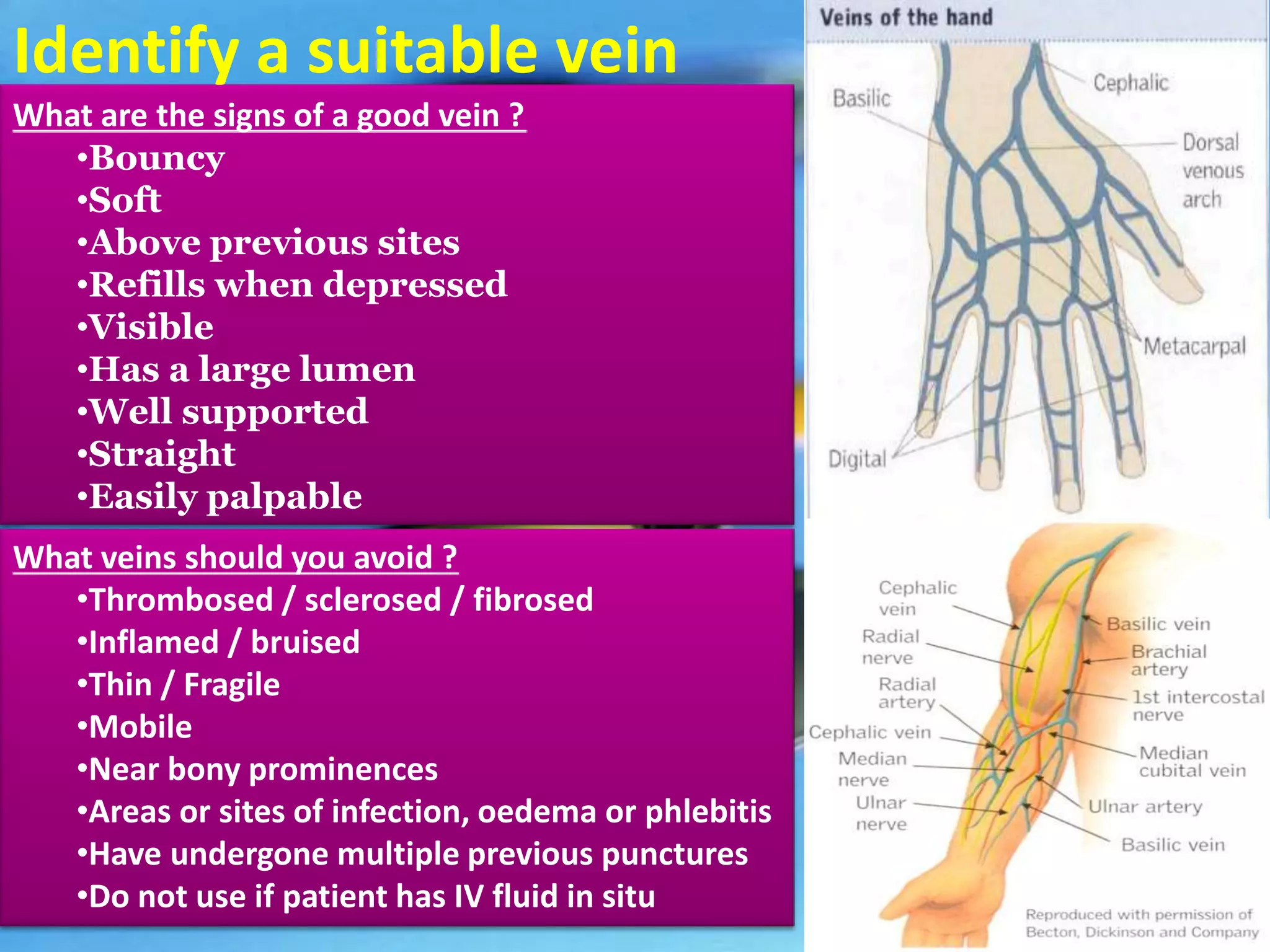 IV CANNULA INSERTION | PPTX