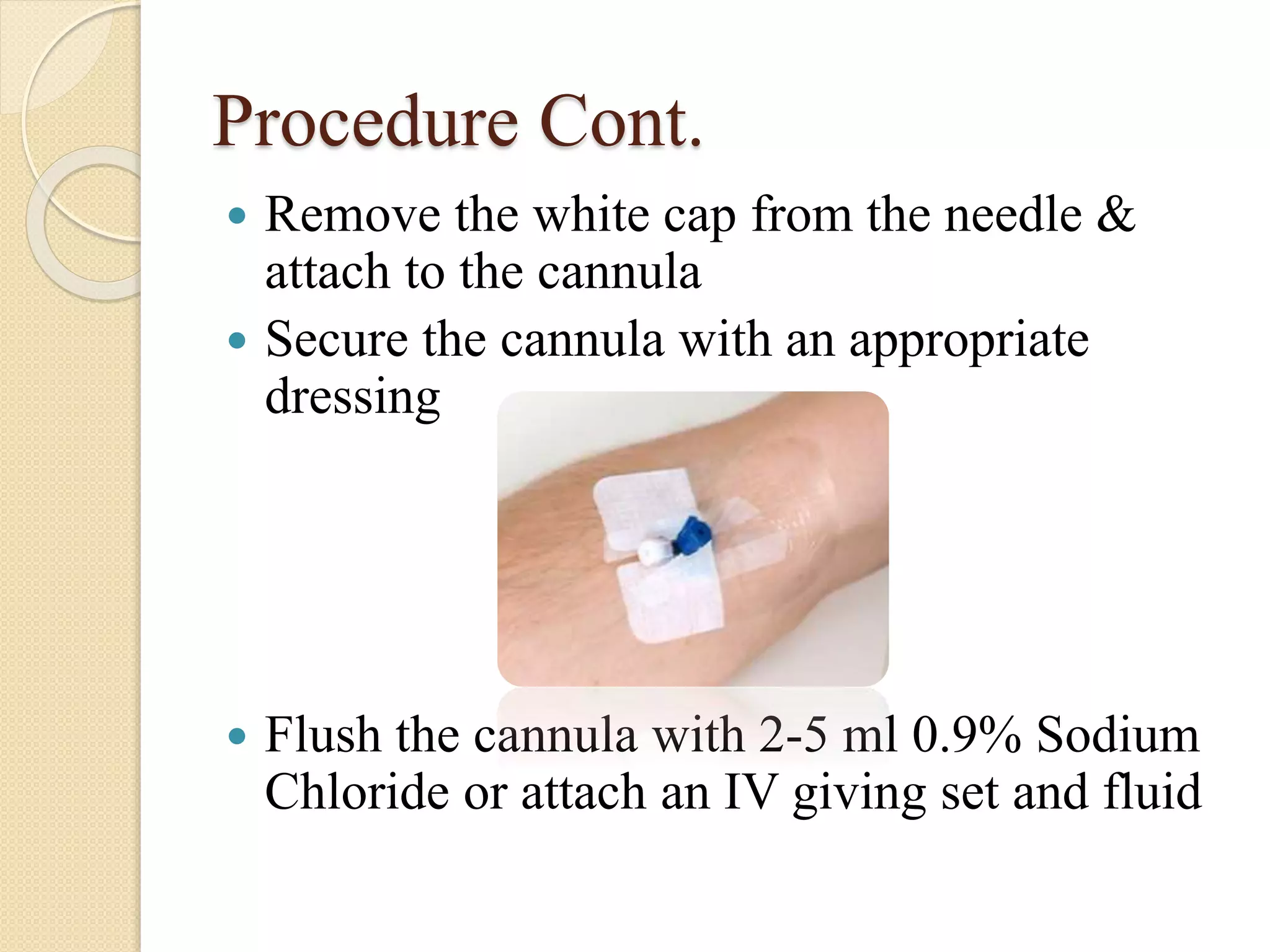 Intravenous cannulation | PPTX