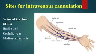 IV cannulajgfftion.pdf