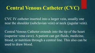 IV cannulajgfftion.pdf