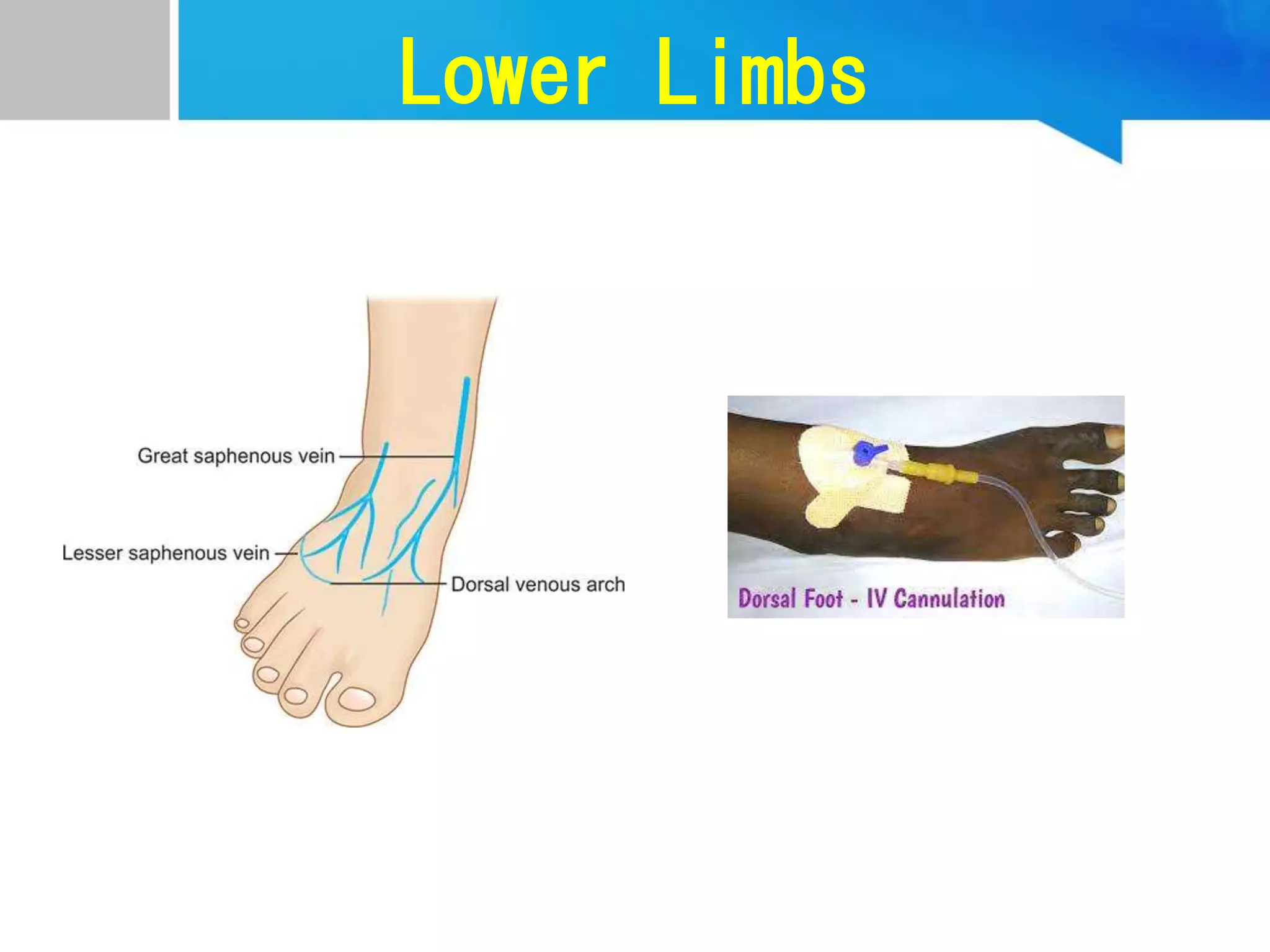 IV Cannulation.ppt