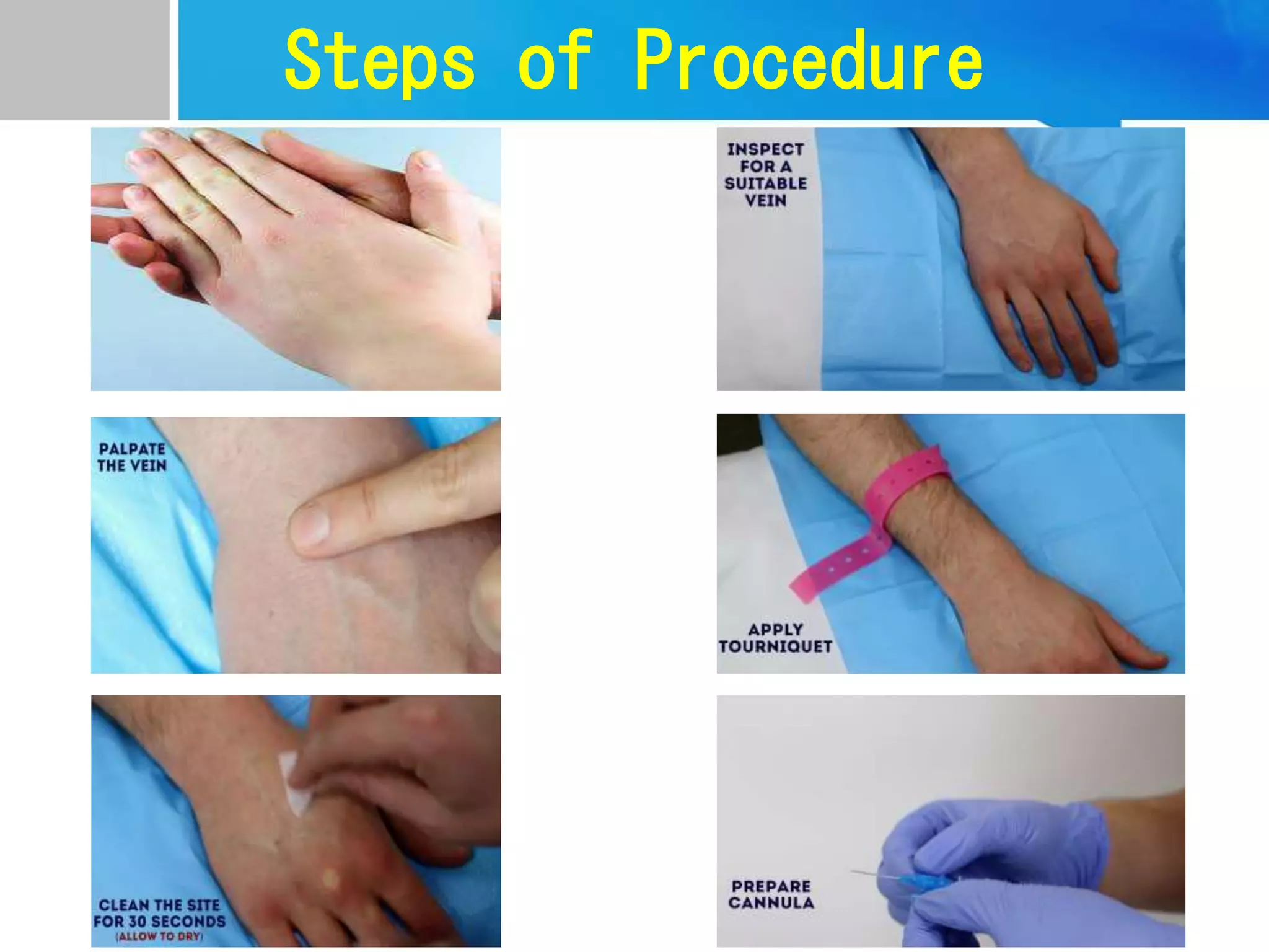 IV Cannulation.ppt